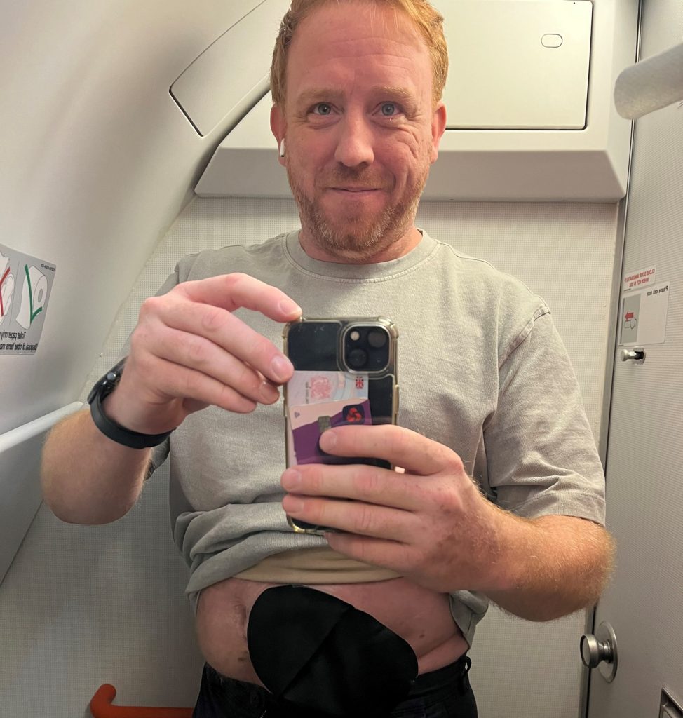 Travelling with a stoma | by Kevin - Eakin Healthcare