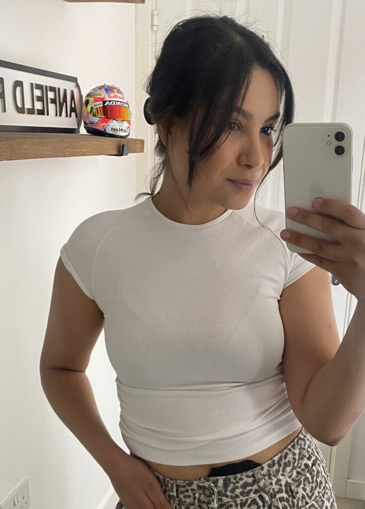 How a stoma changed the way I see my body | by Angelina - Eakin Healthcare